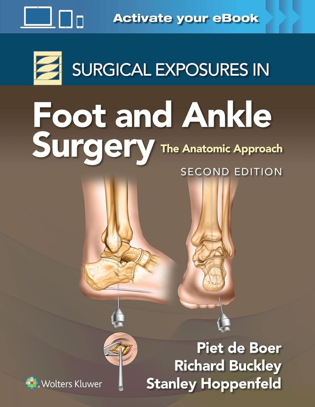 Surgical Exposures in Foot and Ankle Surgery: The Anatomic Approach ...
