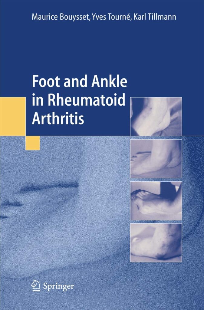 Foot and ankle in rheumatoid arthritis | Podiatry Books NZ